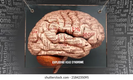 Exploding Head Syndrome Anatomy Causes Effects Stock Illustration ...