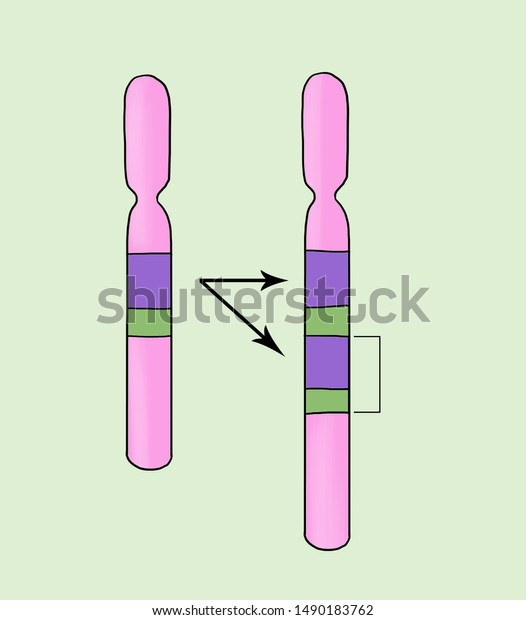 Gene Duplication Sample Chromosome Abnormalities Deletion Stock ...