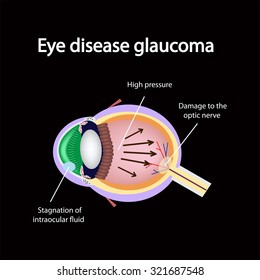 Structure Sebaceous Gland Anatomy Physiology Sebocytes 스톡 일러스트 1222940404