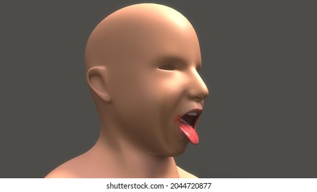 Glossitis Problem Which Tongue Swollen Inflamed3d Stock Illustration ...