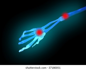 Hand Skeleton X Rays Stock Illustration 37180051 | Shutterstock