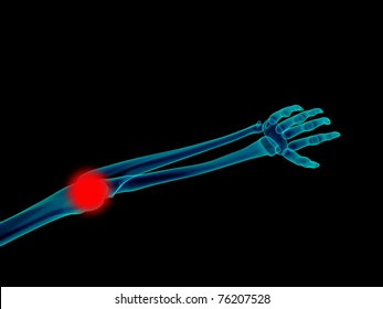 Hand Skeleton X Rays Stock Illustration 75979519