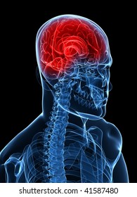 Headache Stock Illustration 41587480 | Shutterstock