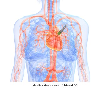 27,122 Heart injection Images, Stock Photos & Vectors | Shutterstock
