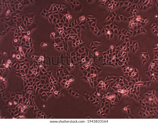 Hela Cells Under Microscope Stock Illustration 1943833564 | Shutterstock