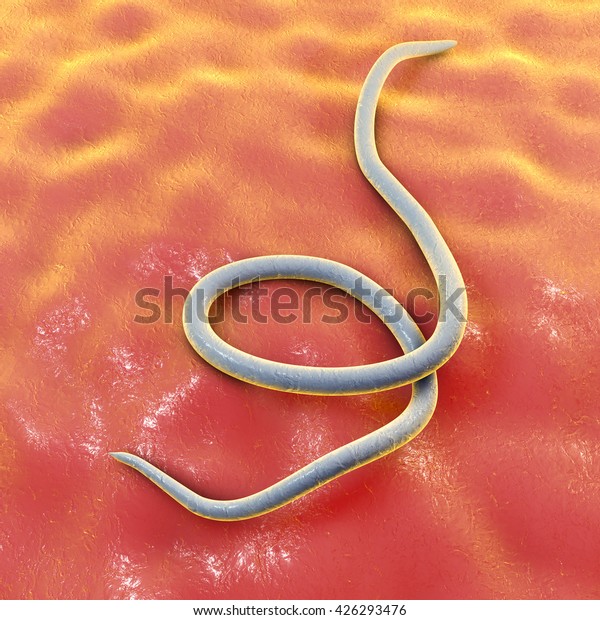 Helminth Nematode Enterobius Threadworm Which Causes Stock Illustration ...