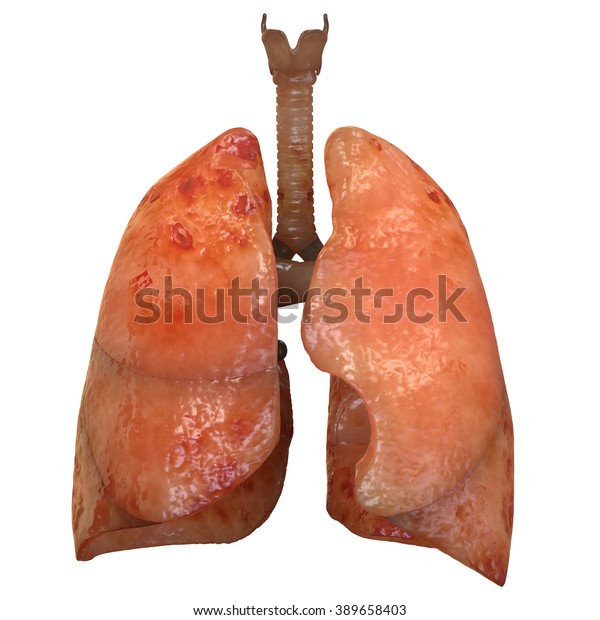 Human Body Organs Lungs Stock Illustration 389658403