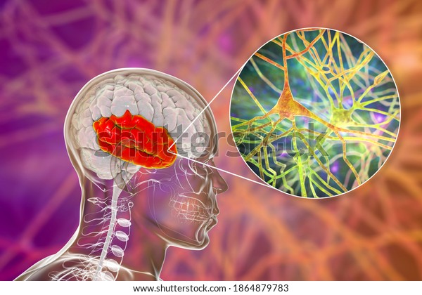 Human Brain Highlighted Temporal Lobe Closeup Stock Illustration 1864879783