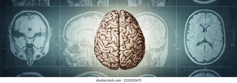 25,470 Cortex background Images, Stock Photos & Vectors | Shutterstock