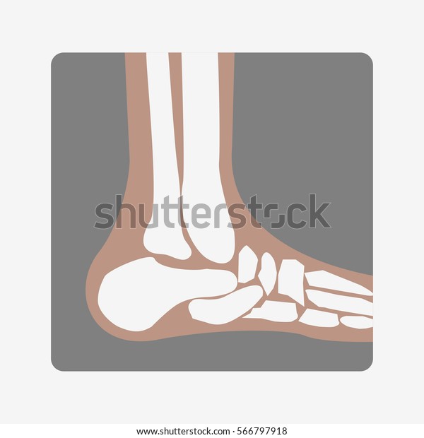 Human Foot Bones Joint Side View Stock Illustration 566797918 ...