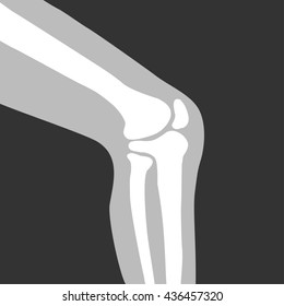 Human Knee Joint Side View Vector: เวกเตอร์สต็อก (ปลอดค่าลิขสิทธิ์ ...
