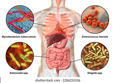 156 Pathogens enter body Images, Stock Photos & Vectors | Shutterstock