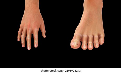 Human Phalanges Hand Leg Bone Anatomy Stock Illustration 2196928243 ...