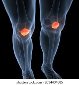 Human Skeleton System Patella Bone Joints: ilustrações stock 2034434885 ...
