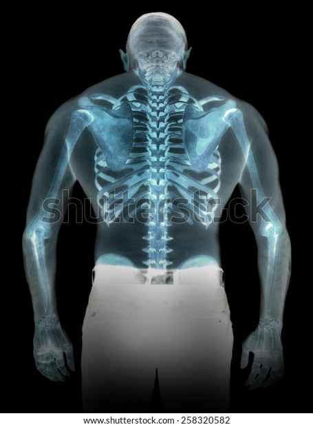 Human Skeleton Under Xrays High Resolution Stock Illustration 258320582 ...