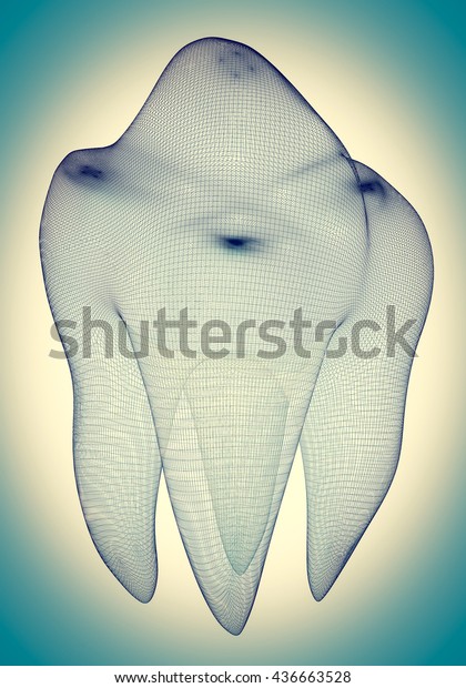 Human Tooth Wire Frame On Background3d Stock Illustration 436663528 ...