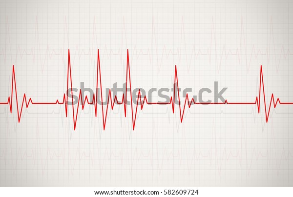 Illustration Heart Desease Irregular Pulsating Medicine Stock ... Illustration Heart Desease Irregular Pulsating Medicine Stock ...