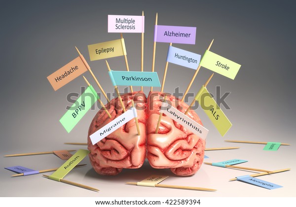 Image Brain On Table Various Nameplates Stock Illustration 422589394