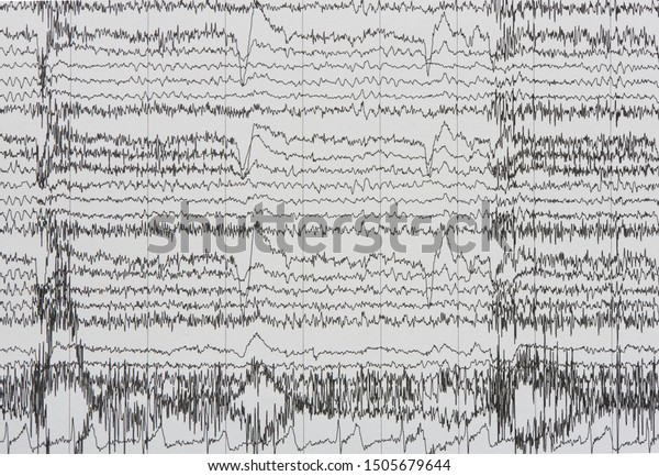 Imaging Brain Waves Electroencephalography Eeg Human Stock Illustration ...