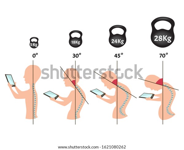 Improper Posture Symptoms Stage Text Neck Stock Illustration 1621080262