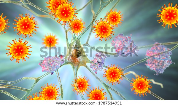 Infectious Etiology Dementia Conceptual 3d Illustration Stock ... Infectious Etiology Dementia Conceptual 3d Illustration Stock ...