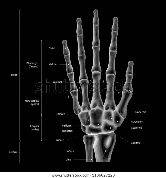 Infographic diagram of human hand bone anatomy system anterior view- 3D ...