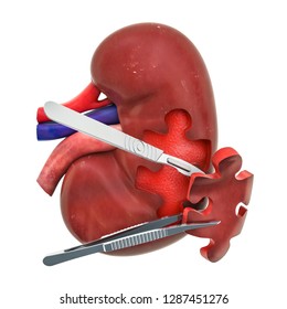 151 Kidney puzzle Images, Stock Photos & Vectors | Shutterstock