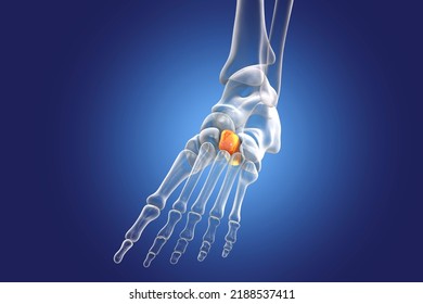 Lateral Third Cuneiform Bone Foot Human Stock Illustration 2188537411 ...