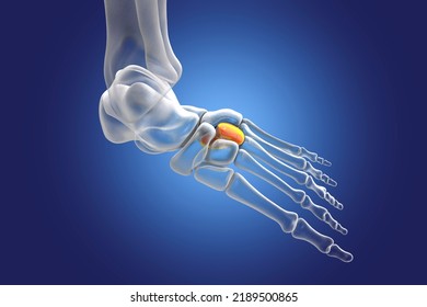 Lateral Third Cuneiform Bone Foot Human Stock Illustration 2189500865 ...