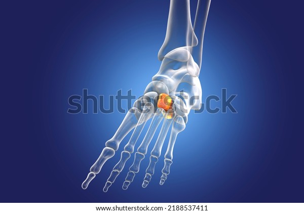 Lateral Third Cuneiform Bone Foot Human Stock Illustration 2188537411 ...