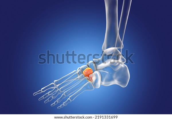 Lateral Third Cuneiform Bone Foot Human Stock Illustration 2191331699 ...