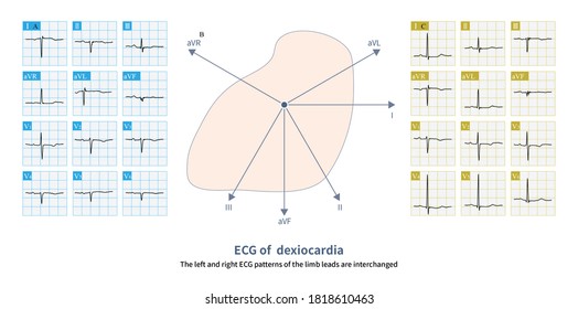 914 Chest leads 图片、库存照片和矢量图 | Shutterstock