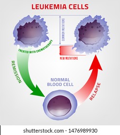 Ilustrasi Stok Leukemia Normal Blood Under Microscope Comparison ...