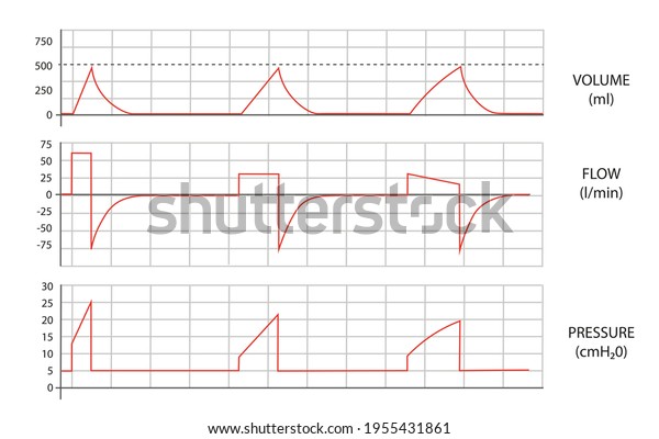 Mechanical Ventilation Waves Volume Flow Pressure Stock Illustration ...
