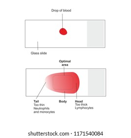 2,724 Blood smear slide Images, Stock Photos & Vectors | Shutterstock