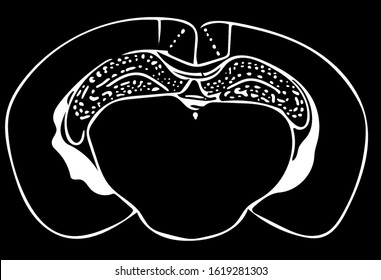 Mouse Brain Slice Section Hippocampus Black: ilustración de stock ...