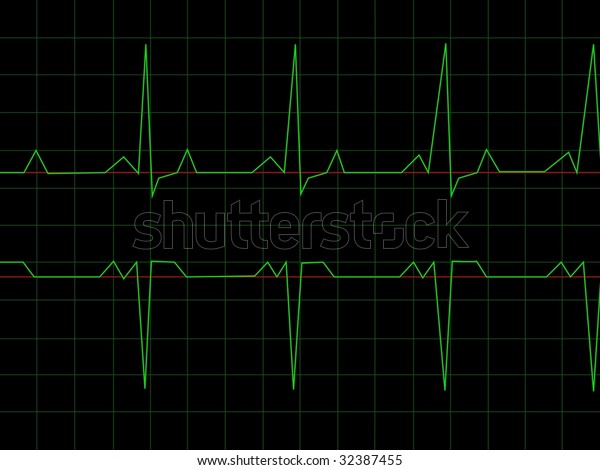 Normal Heart Rhythm Electrocardiogram Ecg Graph Stock Illustration ...