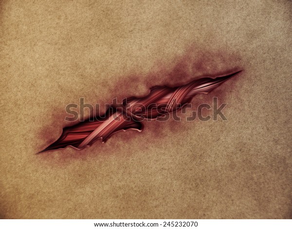 Open Wound Stock Illustration 245232070