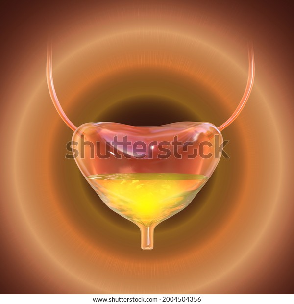 Overactive Urinary Bladder 3d Illustration Condition Stock Illustration ...