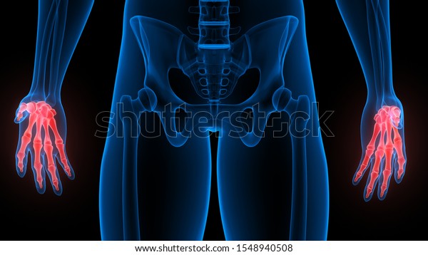 Palm Hand Joints Human Skeleton System Stock Illustration 1548940508 ...