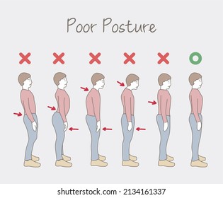 64 Abnormal Extension Images, Stock Photos & Vectors | Shutterstock