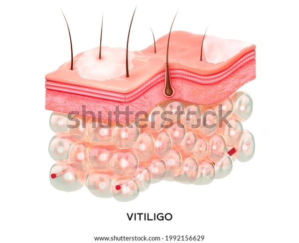 Realistic Human Crosssection Skin Layers Structure Stock Illustration ...