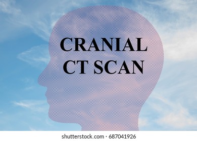 Render Illustration Cranial Ct Scan Title Stock Illustration 687041926 ...