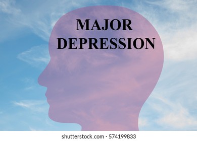 Render Illustration Major Depression Title On 스톡 일러스트 574199833 ...