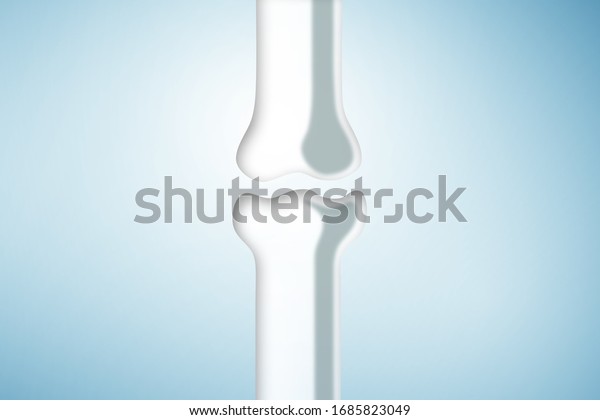 Schematic Illustration Human Bone Joint Stock Illustration 1685823049 ...