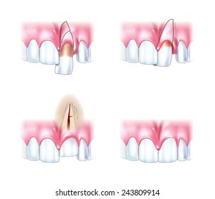 188 Dislocated tooth Images, Stock Photos & Vectors | Shutterstock