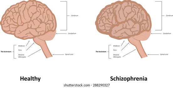 211 The schizophrenic brain Images, Stock Photos & Vectors | Shutterstock