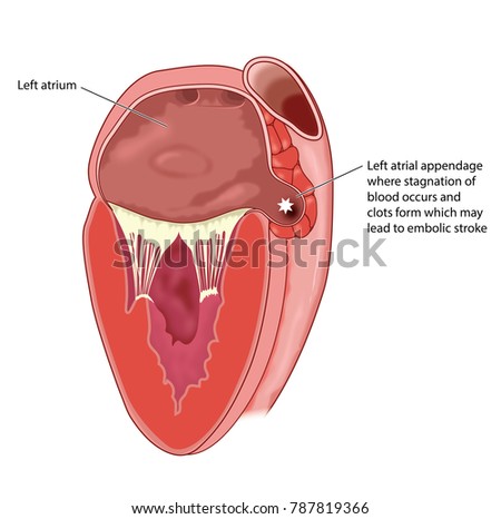 Section Through Heart Showing Left Atrium Stock Illustration 787819366 ...