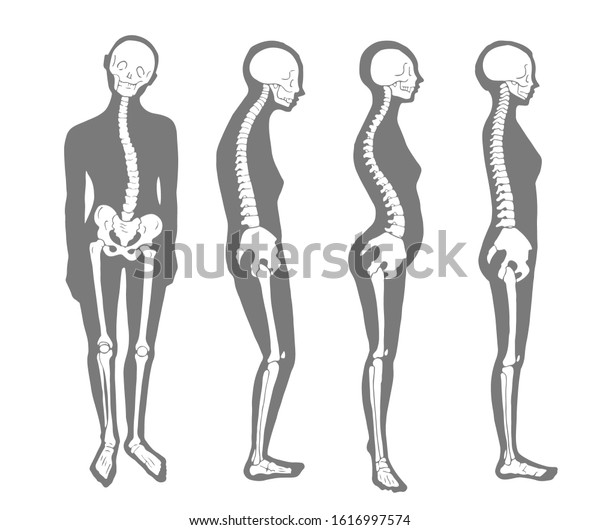 263 Posture Distortions Images, Stock Photos & Vectors | Shutterstock