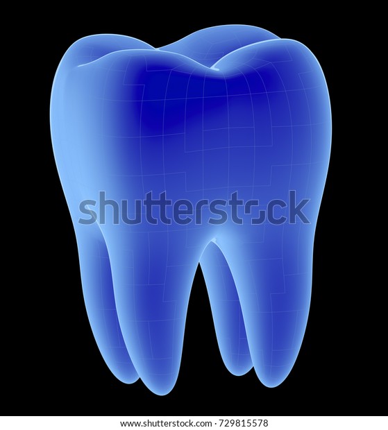 Side View Human Tooth Xray Scan Stock Illustration 729815578 | Shutterstock